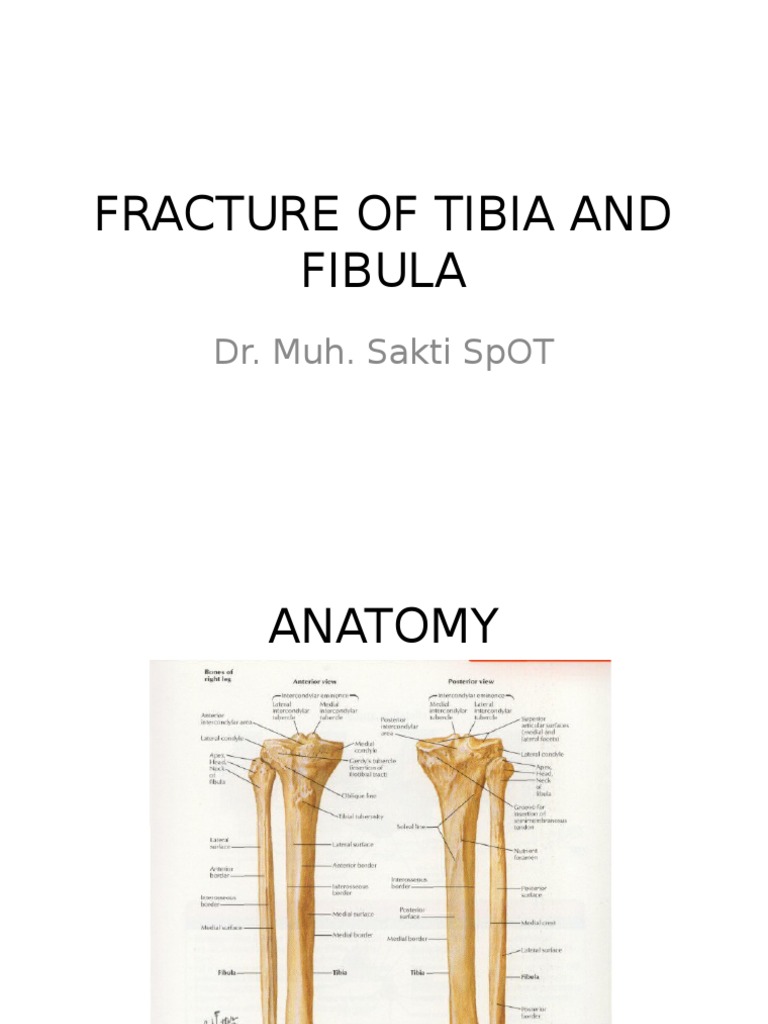 Tibia and Fibula Fracture Guide | PDF