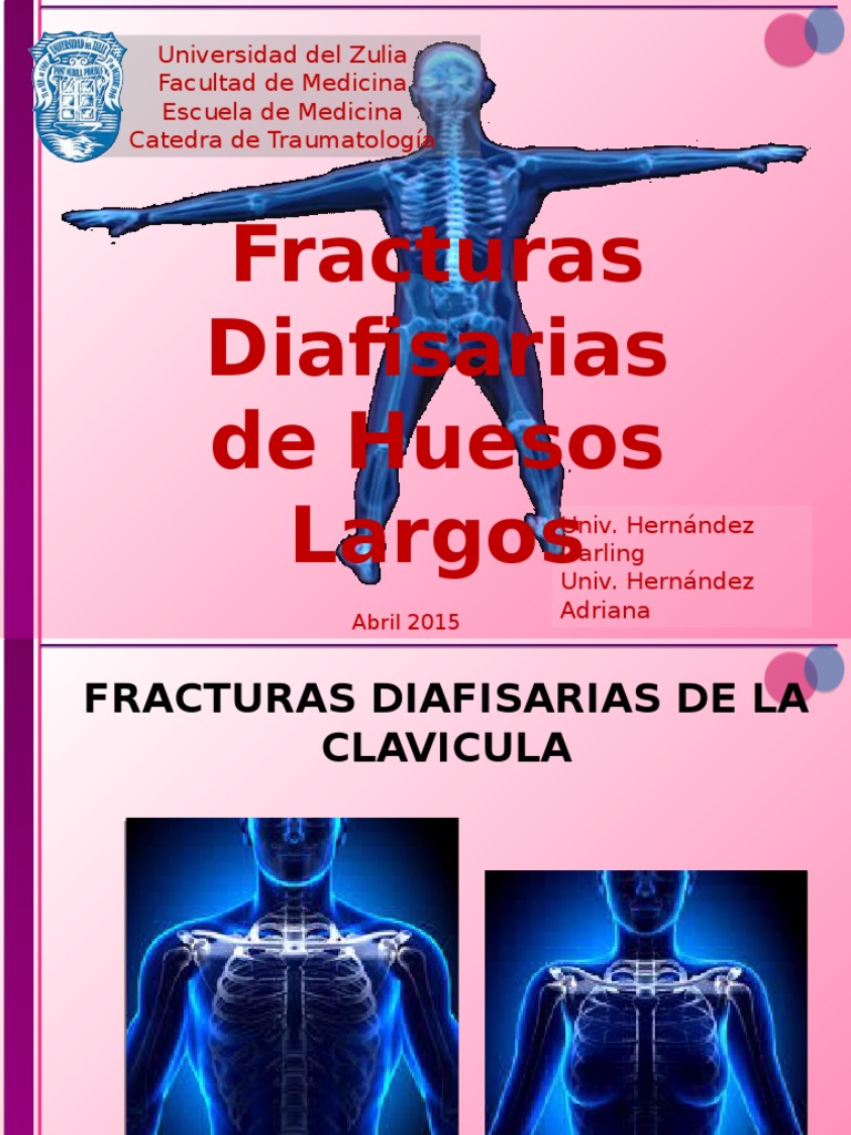 FX Diafisis Huesos Largo | PDF | Mano | Hueso
