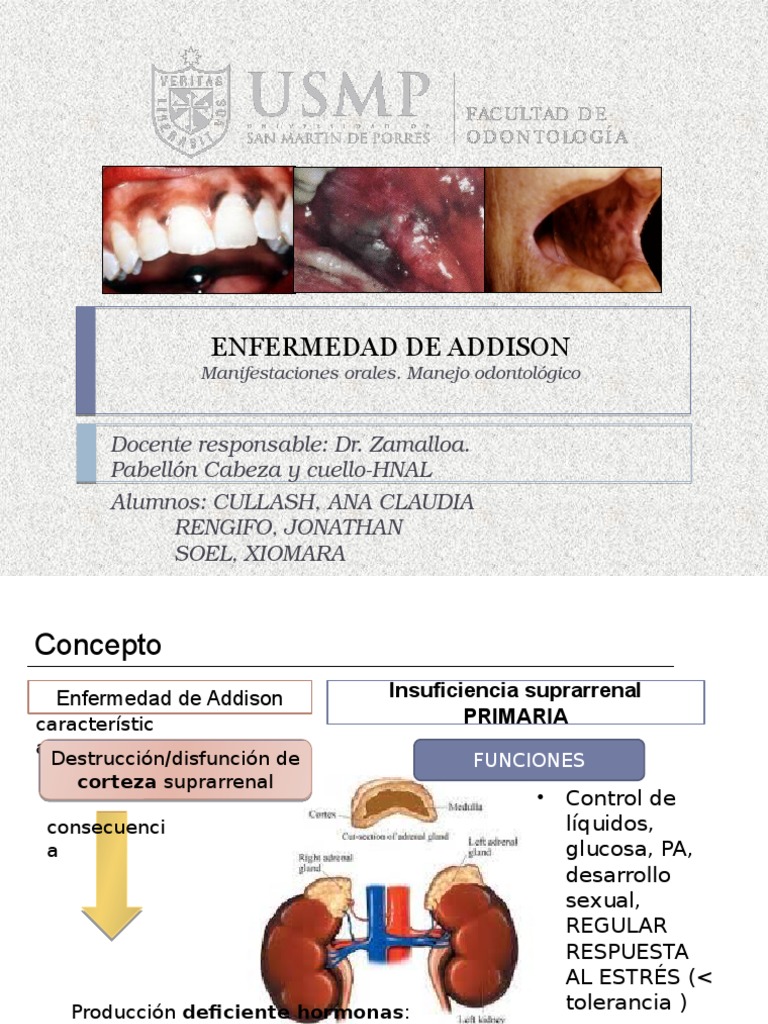 Enfermedad de Addison | PDF | Glándula suprarrenal | Sistema endocrino