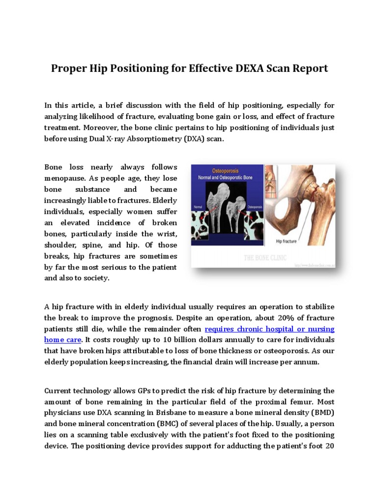 Proper Hip Positioning for Effective DEXA Scan Report | Osteoporosis | Hip