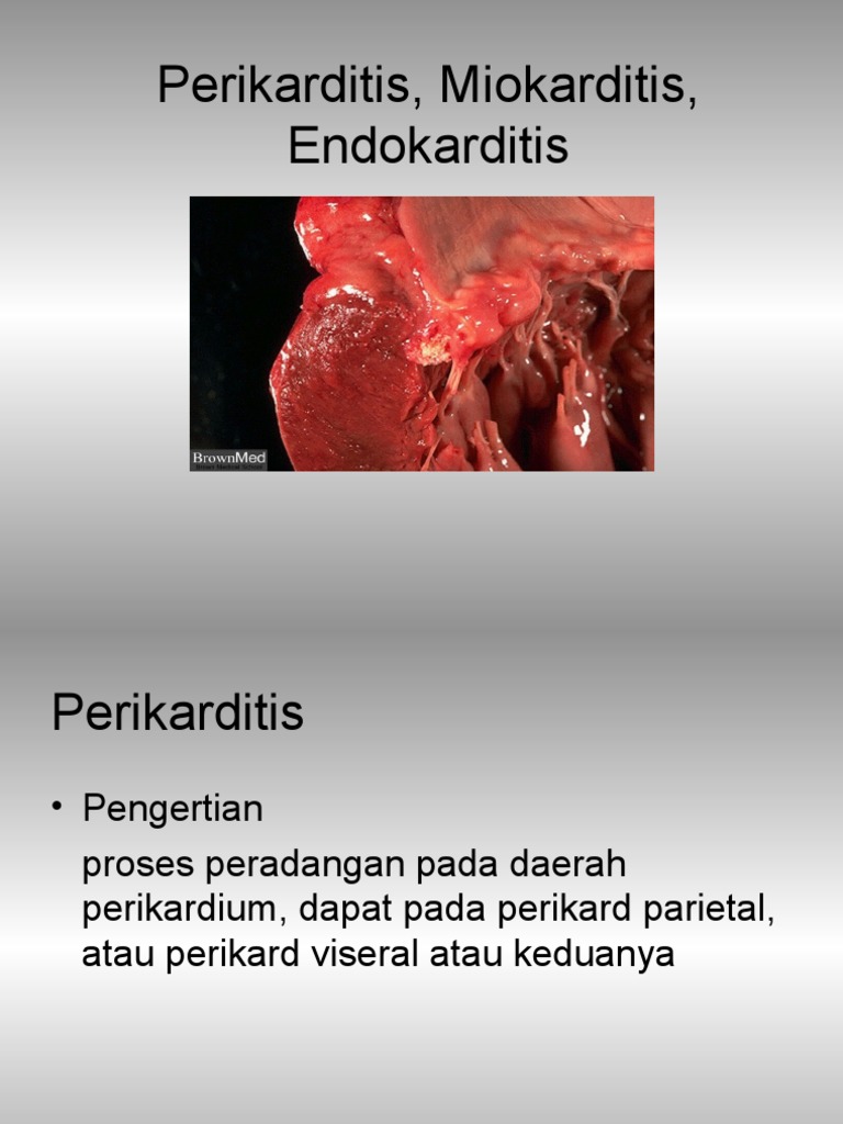 Perikarditis, Miokarditis, Endokarditis
