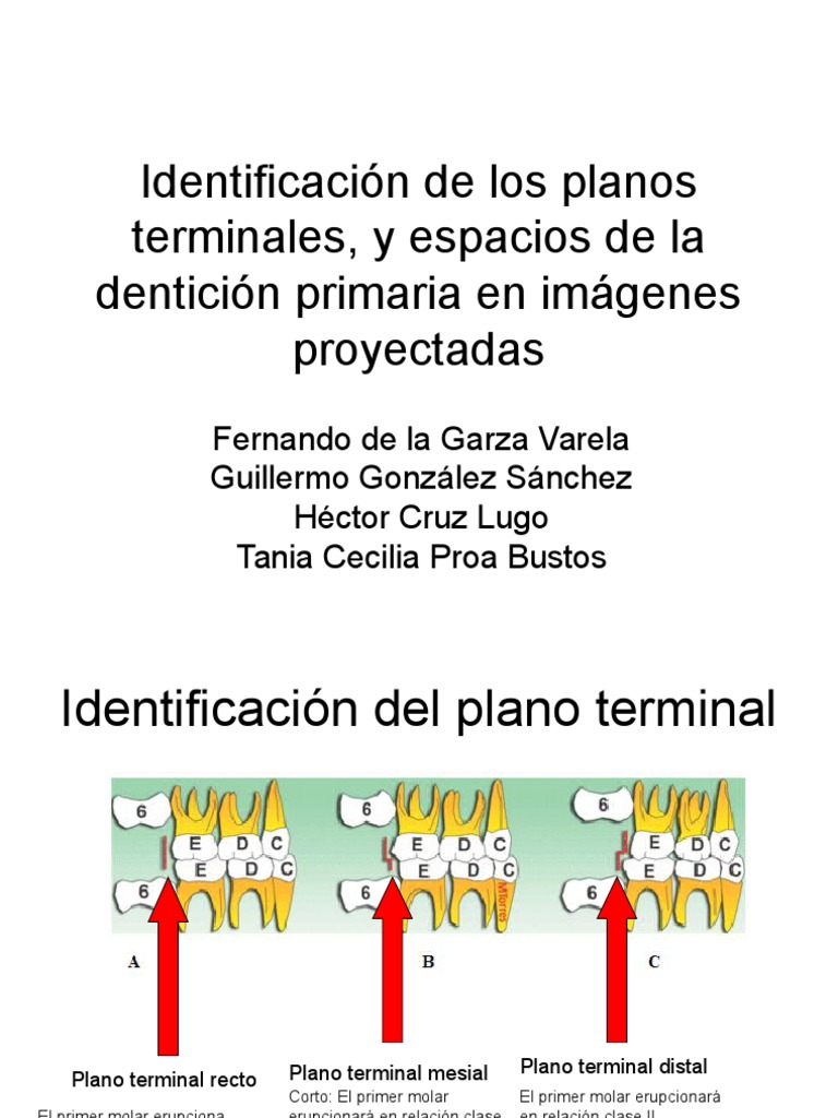 Identificación de Los Planos Terminales, y Espacios | PDF | Diente ...