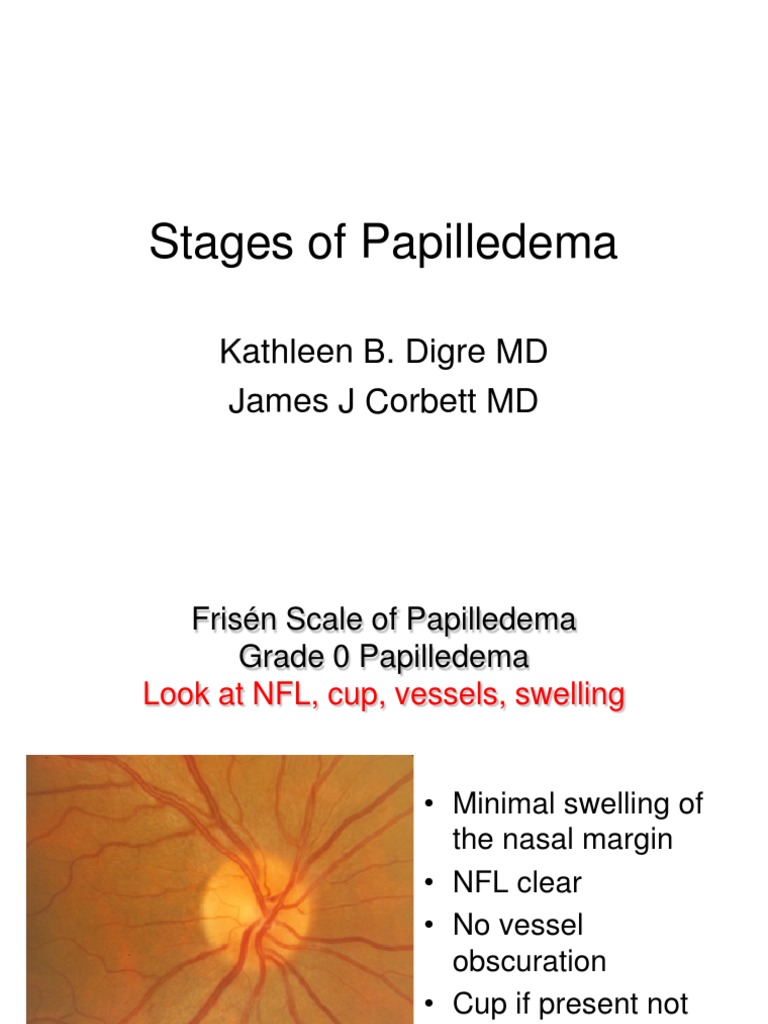 Papilledema Grading