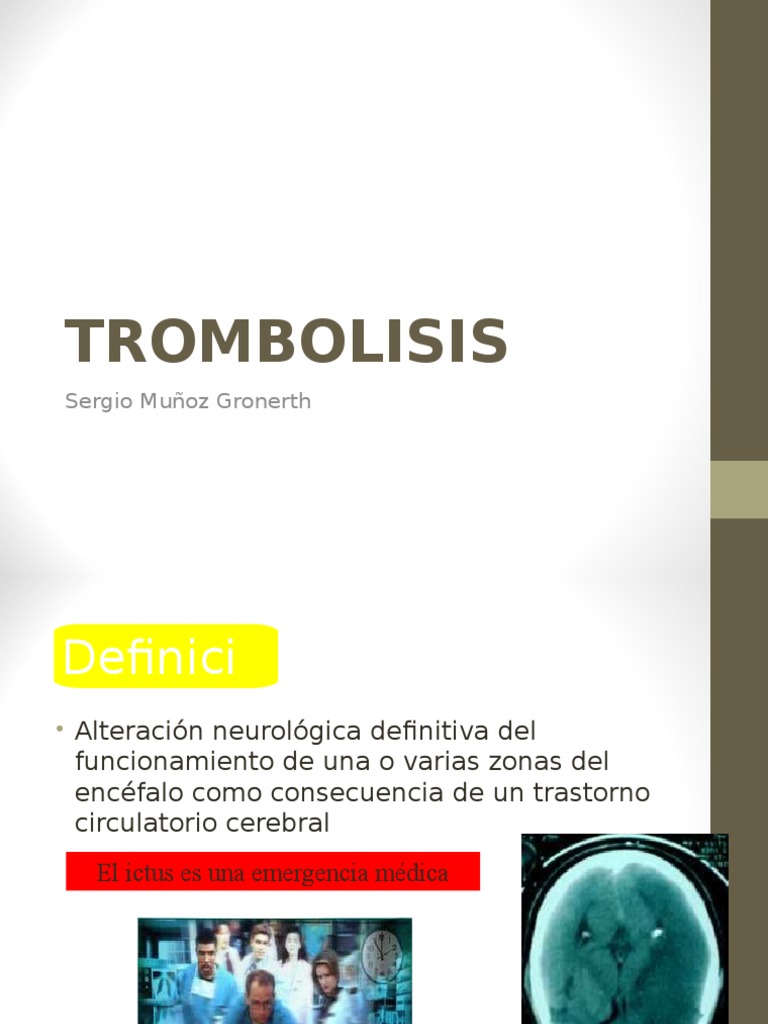 Trombolisis | Infarto agudo de miocardio | Terapia intravenosa