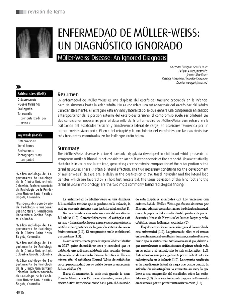Sindrome Muller Weiss | PDF | Pie | Sistema musculoesquelético