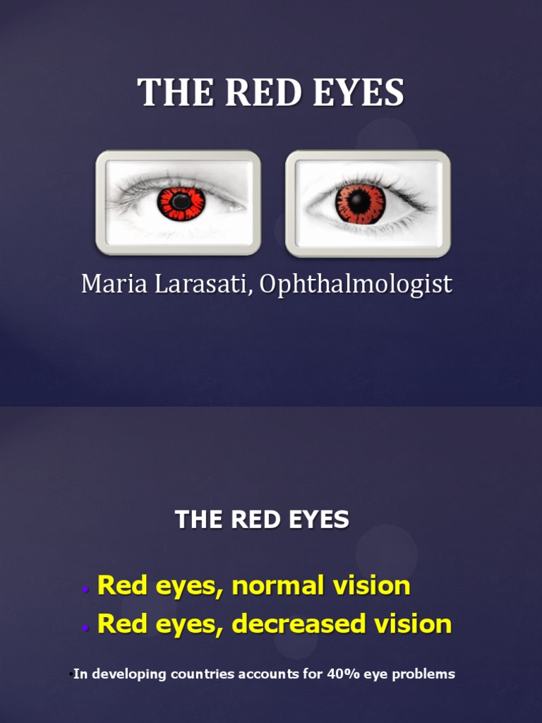 Red Eye | PDF | Cornea | Diseases Of The Eye And Adnexa