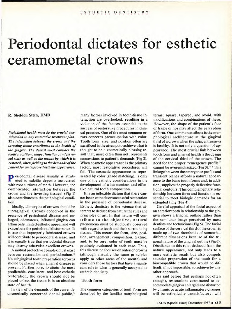 Periodontal Dictates For Esthetic Ceramometal Crowns: R - Sheldon Stein ...