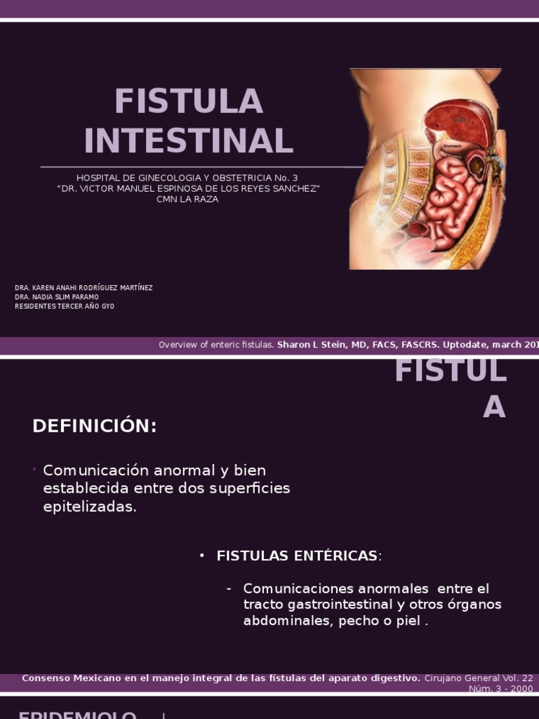 Fistulas Intestinales | Sistema digestivo humano | Anatomia animal