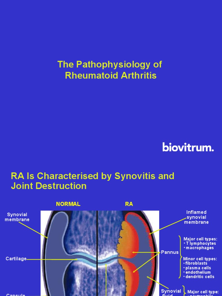 Pa Tho Physiology of Ra | Download Free PDF | Inflammation | Rheumatoid ...