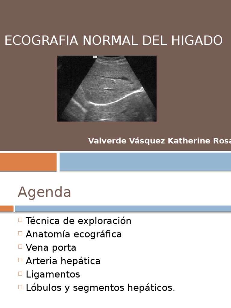 Ecografia Normal de Higado | Hígado | Bazo
