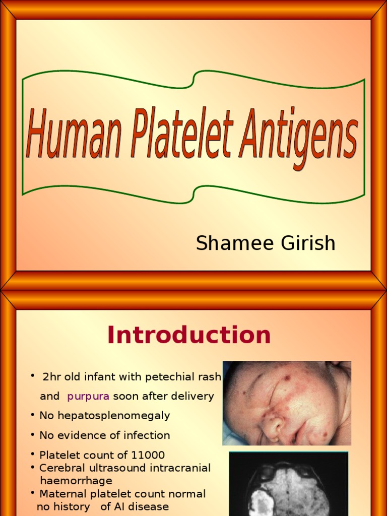 Human Platelet Antigen | PDF | Antibody | Monoclonal Antibody