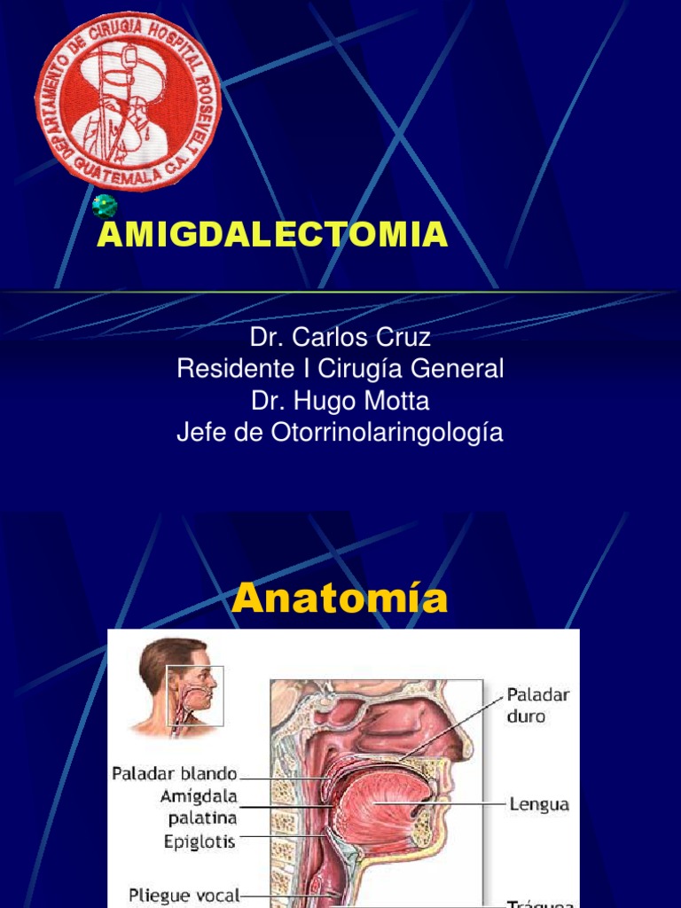 Amigdalectomia | Cirugía | Especialidades Medicas