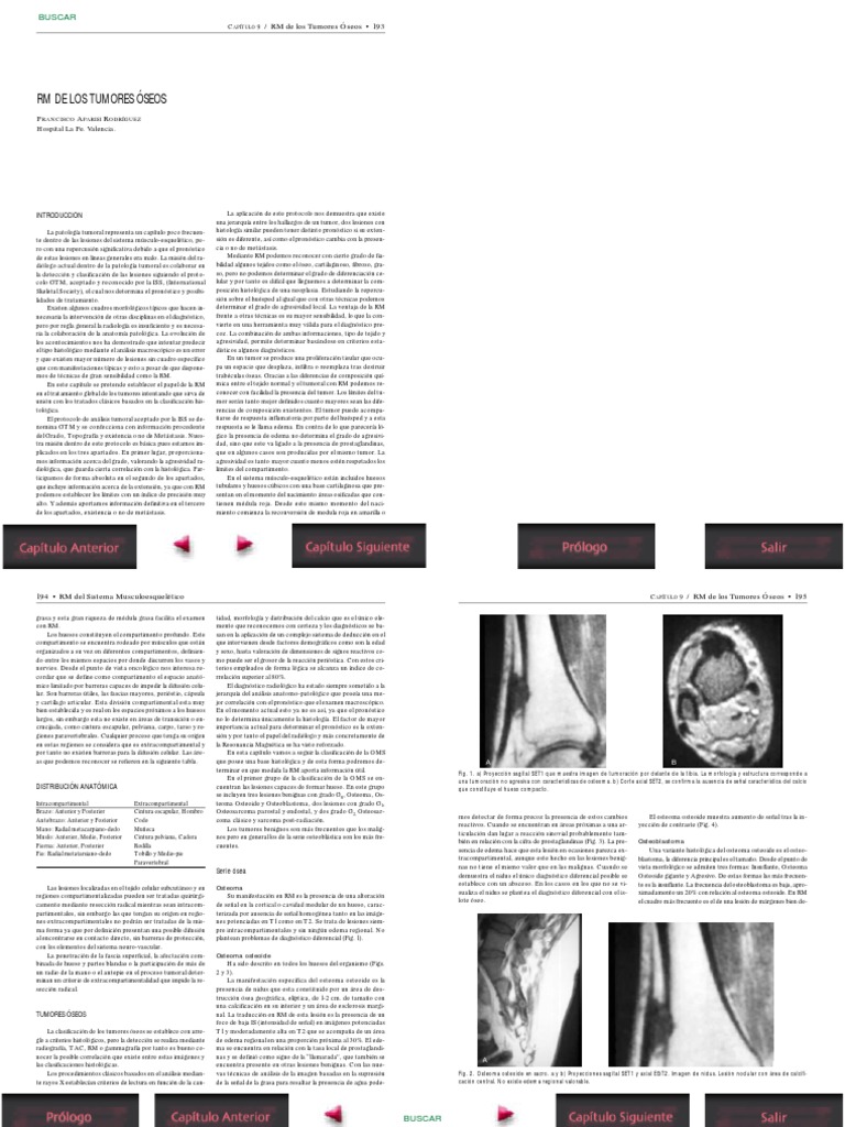 RM Tumores Oseos | PDF | Hueso | Cáncer