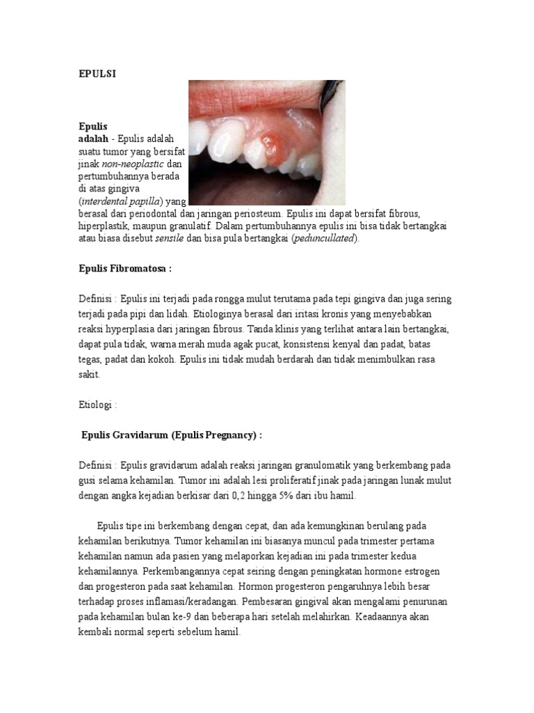 Tumor Jinak di Rongga Mulut | PDF