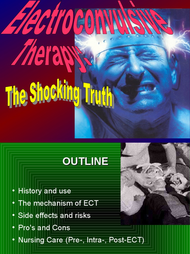 ECT | Electroconvulsive Therapy | Psychiatry