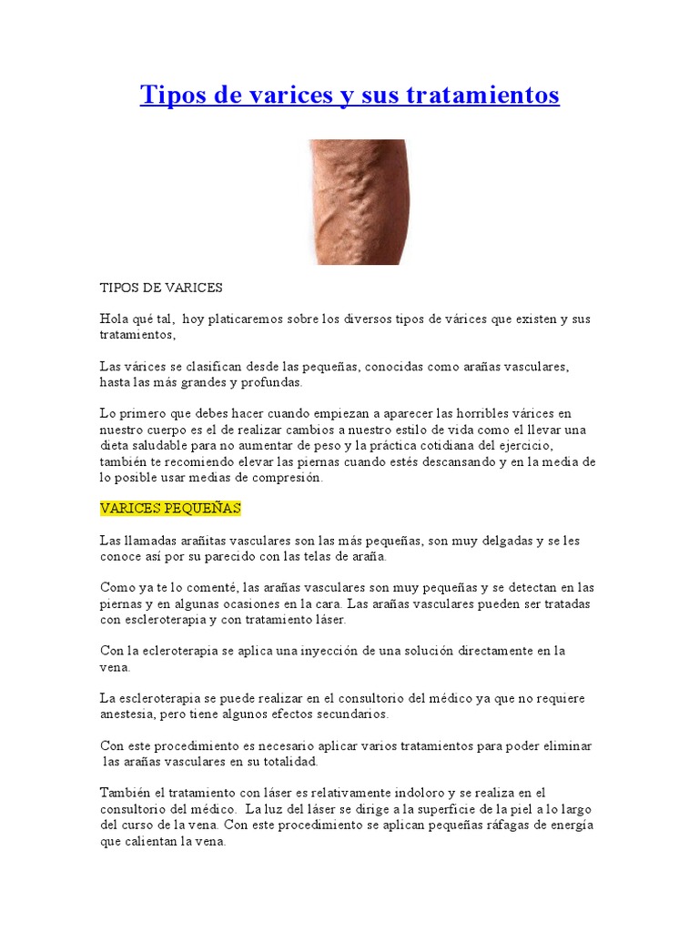 Tipos de Varices y Sus Tratamientos | PDF | Venas varicosas | Ciencias ...