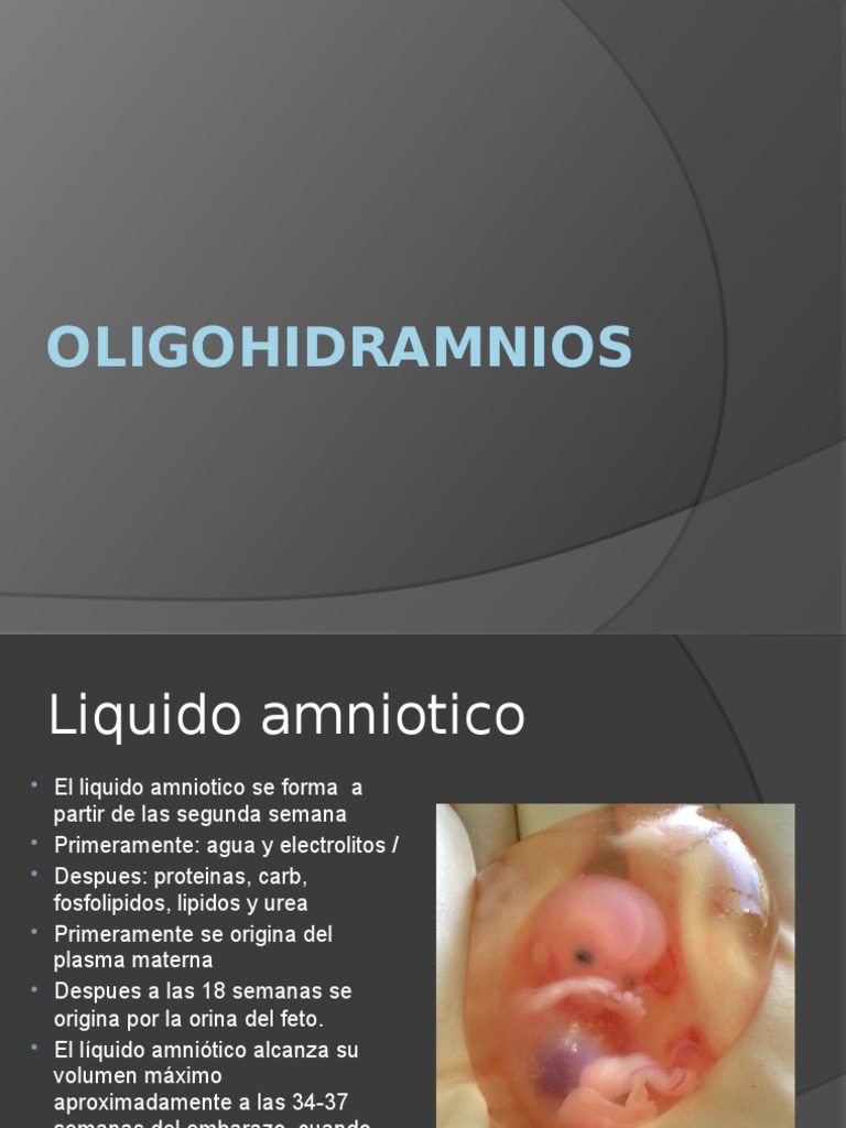 Oligohidramnios: Definición y Causas | PDF | Especialidades Medicas ...