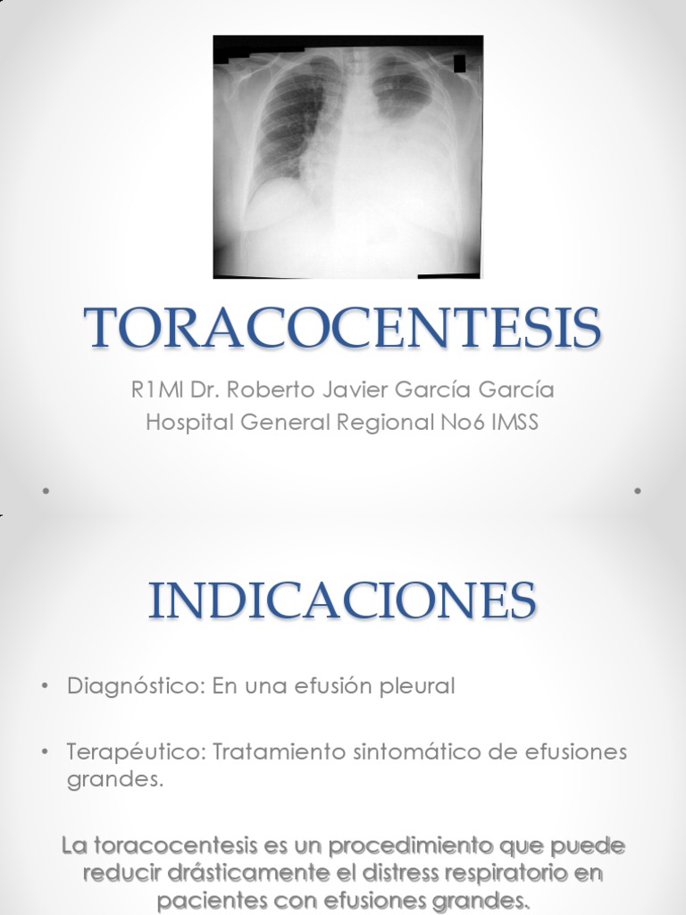 Toracocentesis | PDF | Medicina | Enfermedades y trastornos
