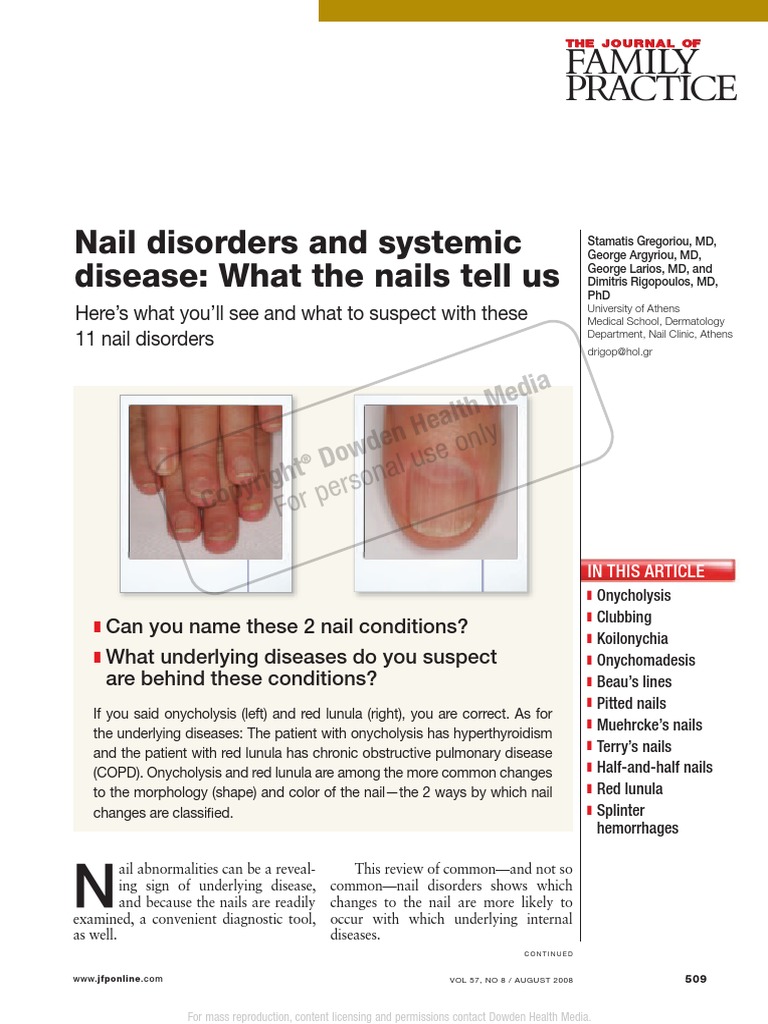 Nail Disorder | PDF | Nail (Anatomy) | Health Sciences