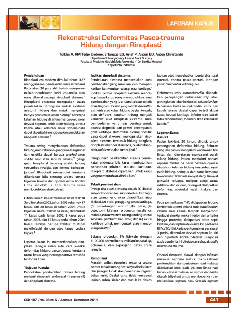 Rekontruksi Deformitas Pasca-Trauma Hidung Mastoid) J | PDF