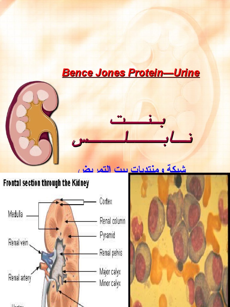 Bence Jones Protein-Urine | PDF | Multiple Myeloma | Kidney