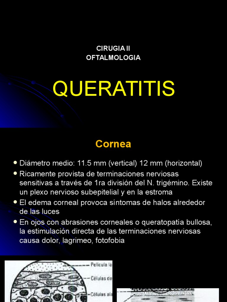 Queratitis | PDF | Córnea | Oftalmología