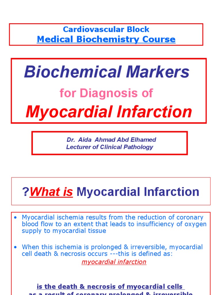 Biomarkers For Myocardial Infarction, CVS Block | PDF | Myocardial ...