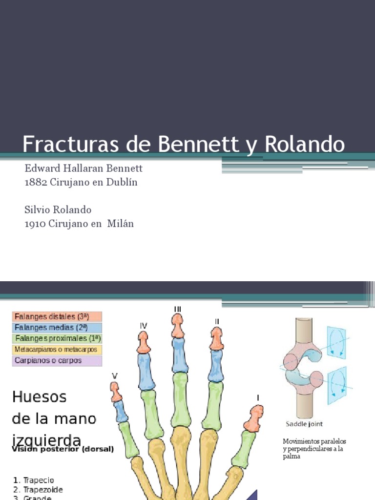 Fracturas de Bennett y Rolando