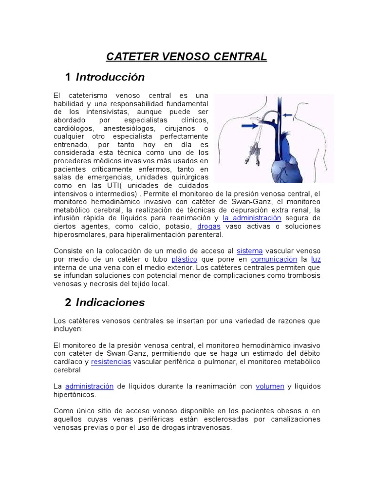 Cateter Venoso Central | La columna vertebral | Vértebra