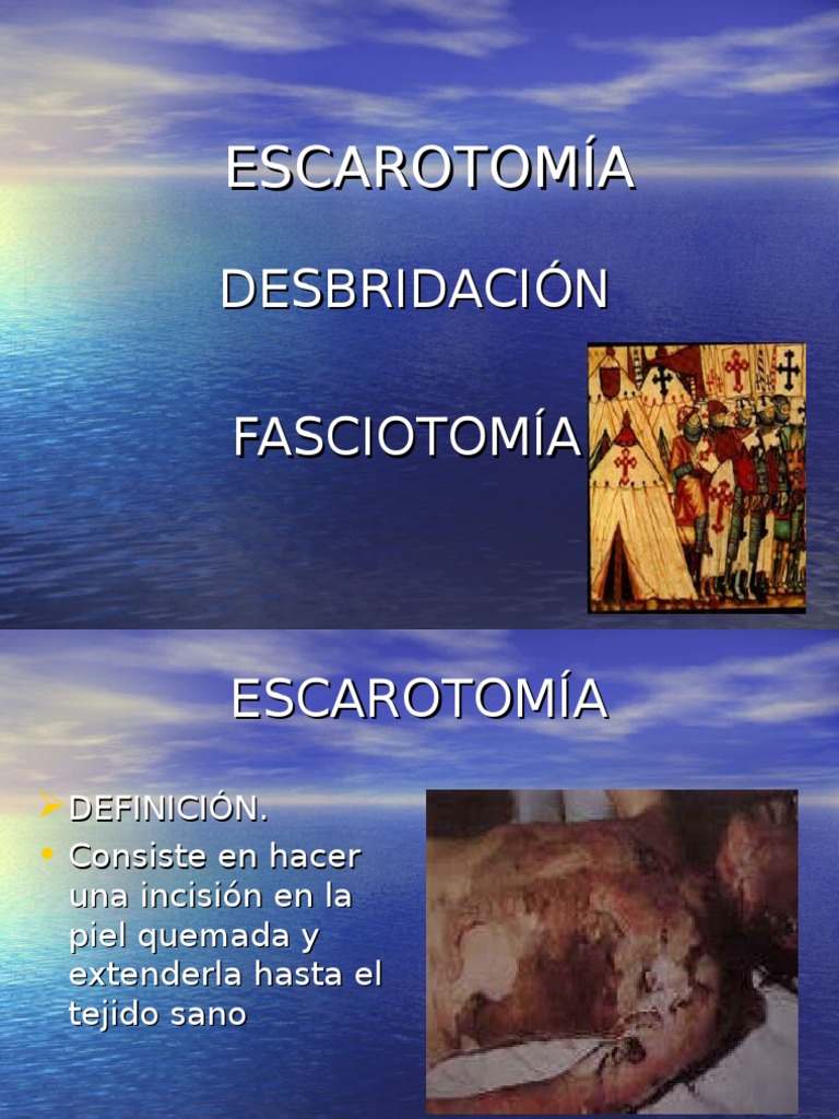 Escarotomía y Fasciotomía en Quemaduras | PDF | Herida | Quemar