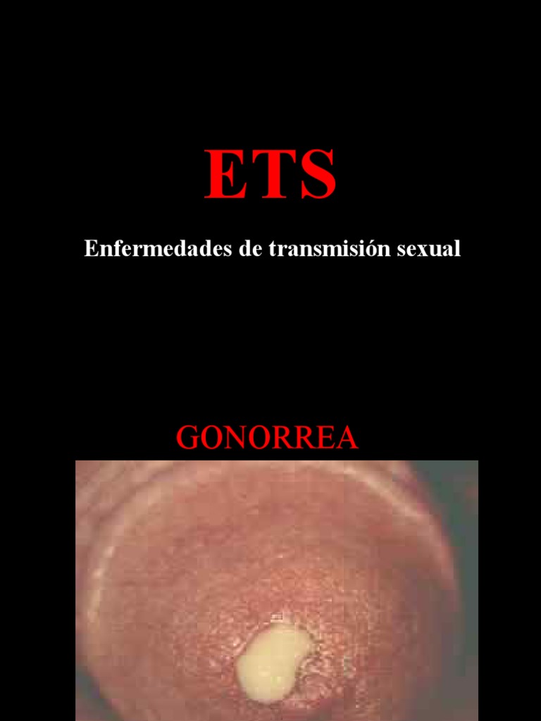 ETS Imagenes | PDF | Infección transmitida sexualmente | VIH / SIDA