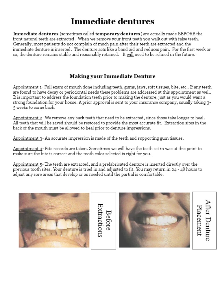 Info Immediate Dentures | PDF | Dentures | Medical Specialties
