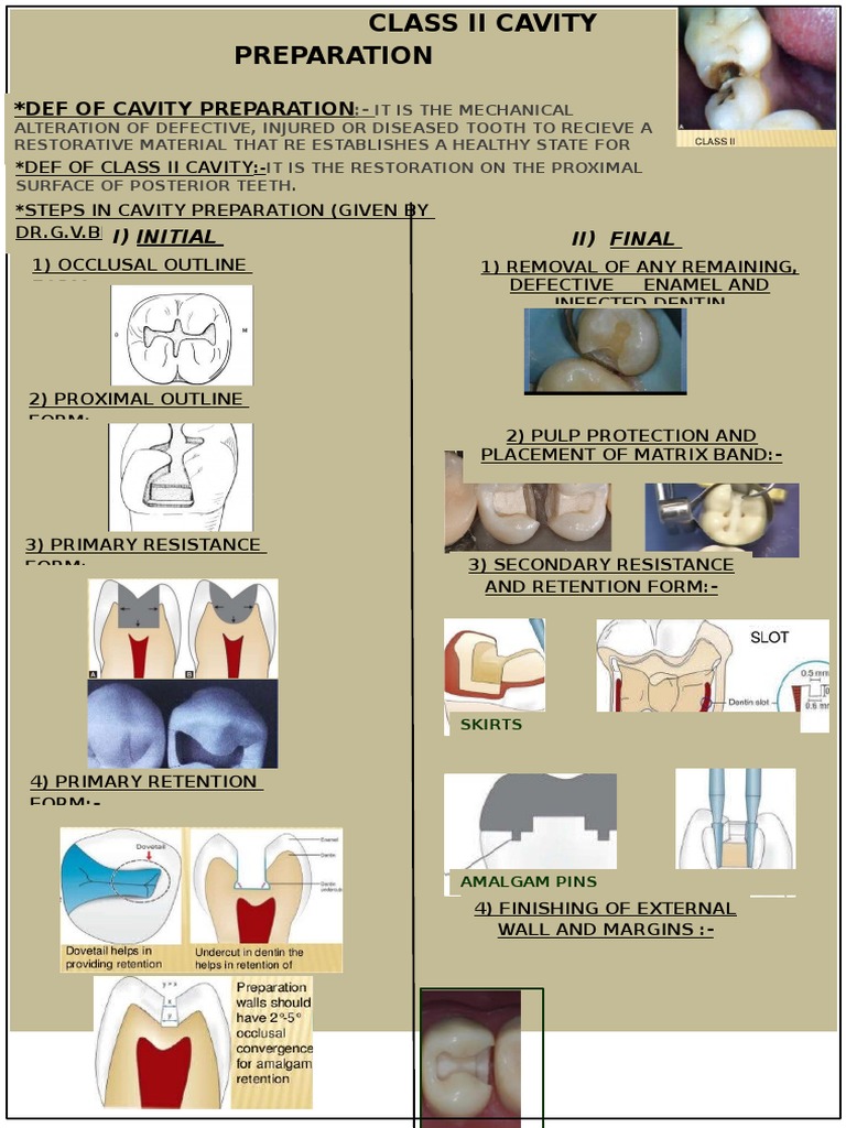 Class II Cavity Preparation | PDF | Technology & Engineering