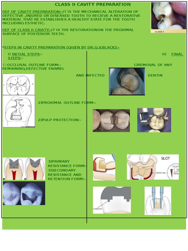 Class II Cavity Preparation 2 | PDF