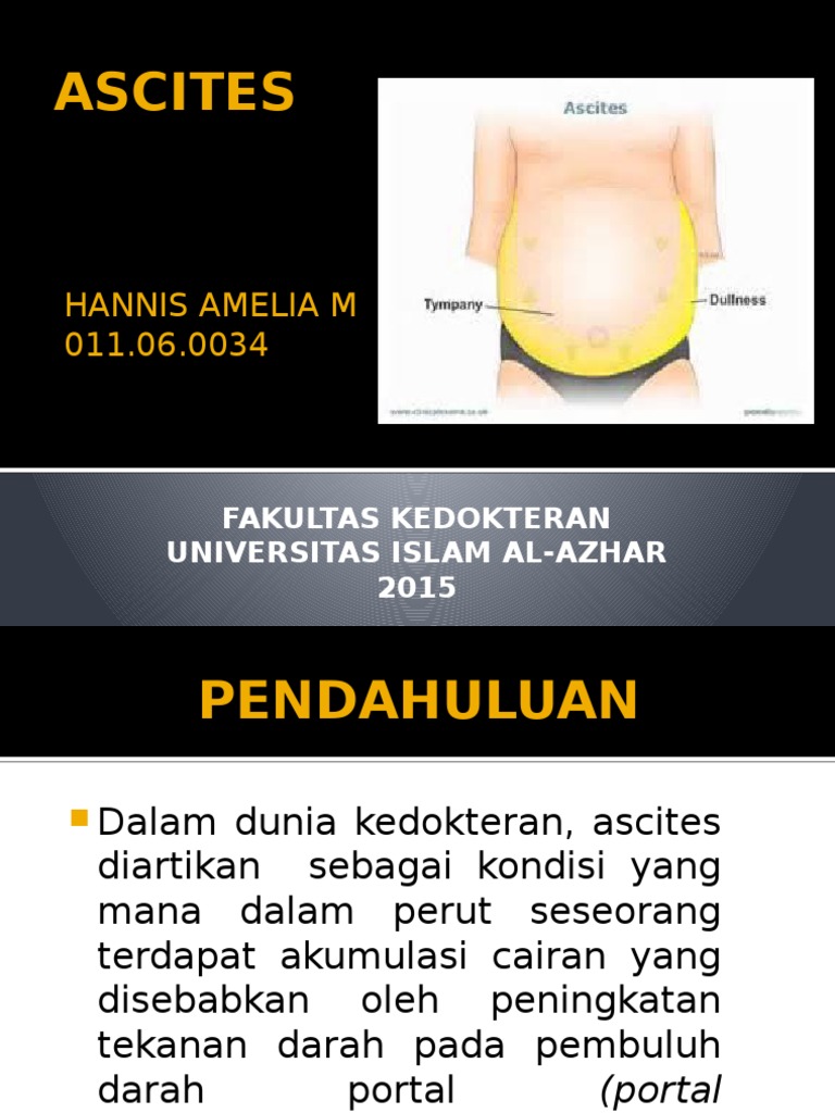 Ascites | PDF