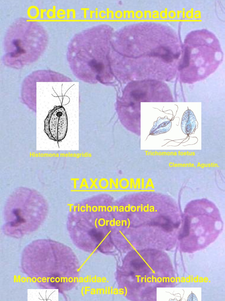 Trichomonas Spp JUNIO 2015 | Ciencias de la tierra y de la vida | Biología