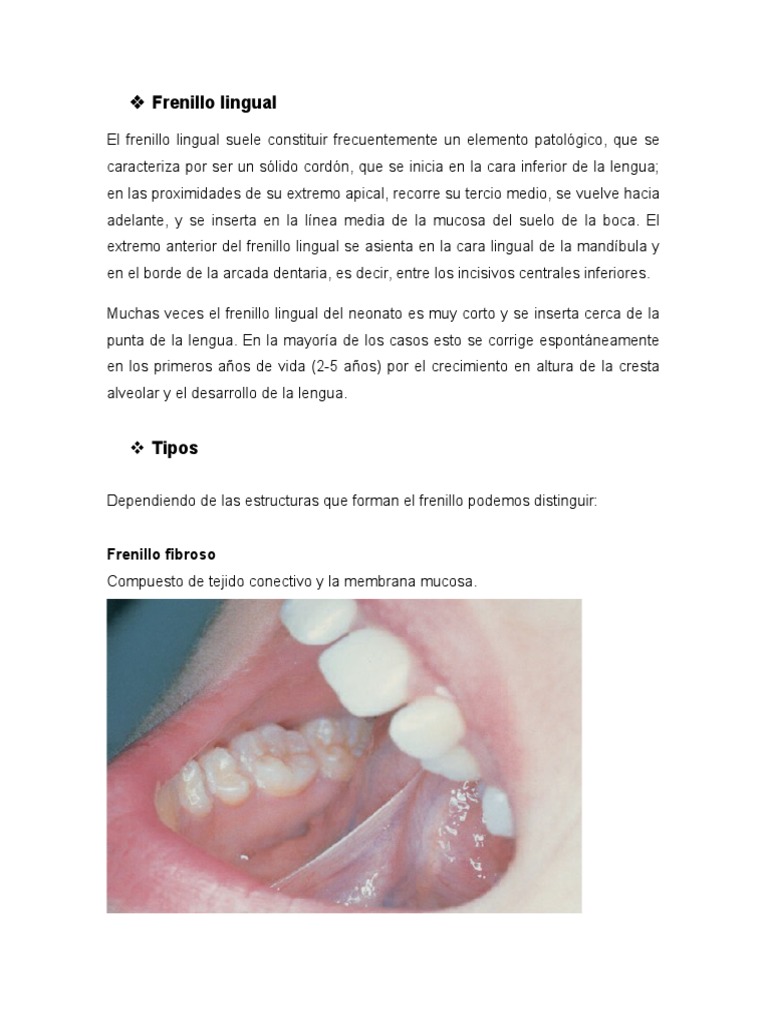 Frenillo Lingual | Lengua | Anatomía humana