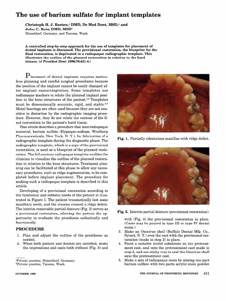 The Use of Barium Sulfate For Implant Templates | PDF | Dental Implant ...