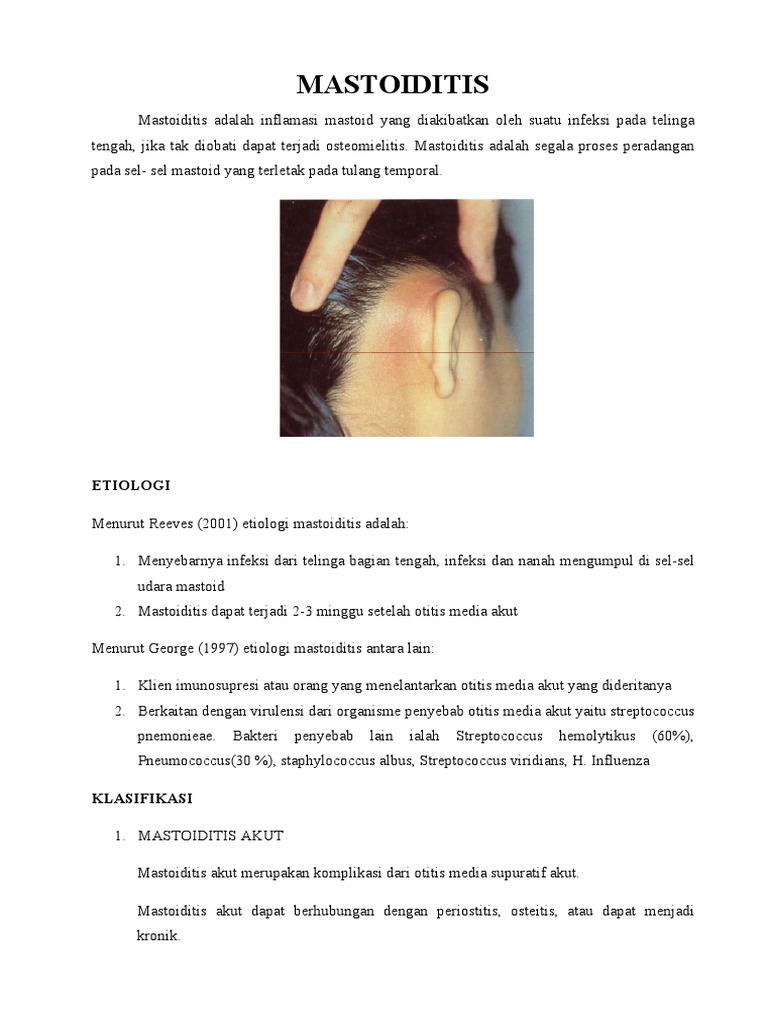 Mengobati Mastoiditis: Tinjauan Etiologi, Patofisiologi, Gejala Klinis ...