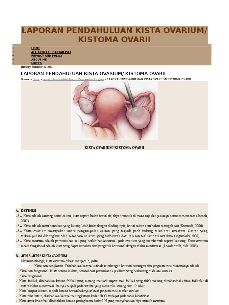 Laporan Pendahuluan Kista Ovarium | PDF