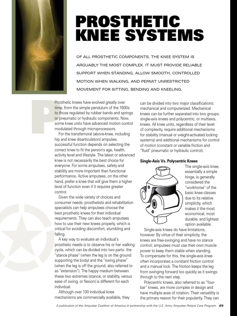 Prosthetic Knee Systems | Prosthesis | Walking