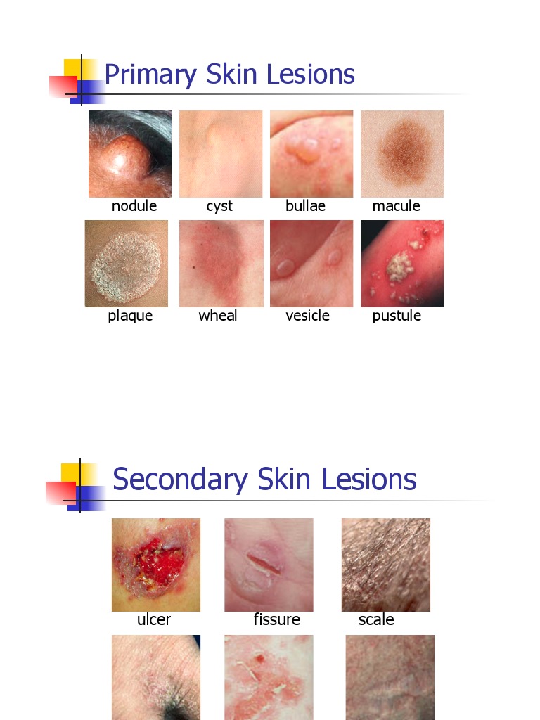 Skin Final Year | PDF | Dermatitis | Cutaneous Conditions