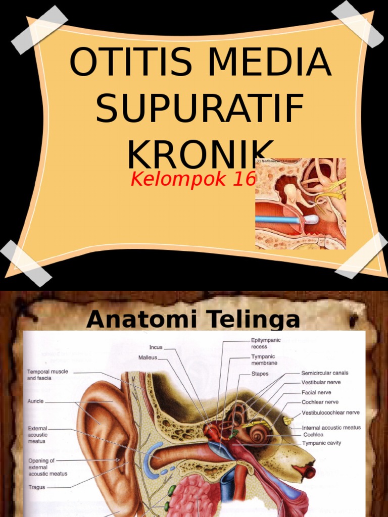 Otitis Media Supuratif Kronik