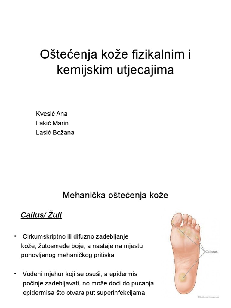 Oštećenja Kože Fizikalnim I Kemijskim Utjecajima | PDF