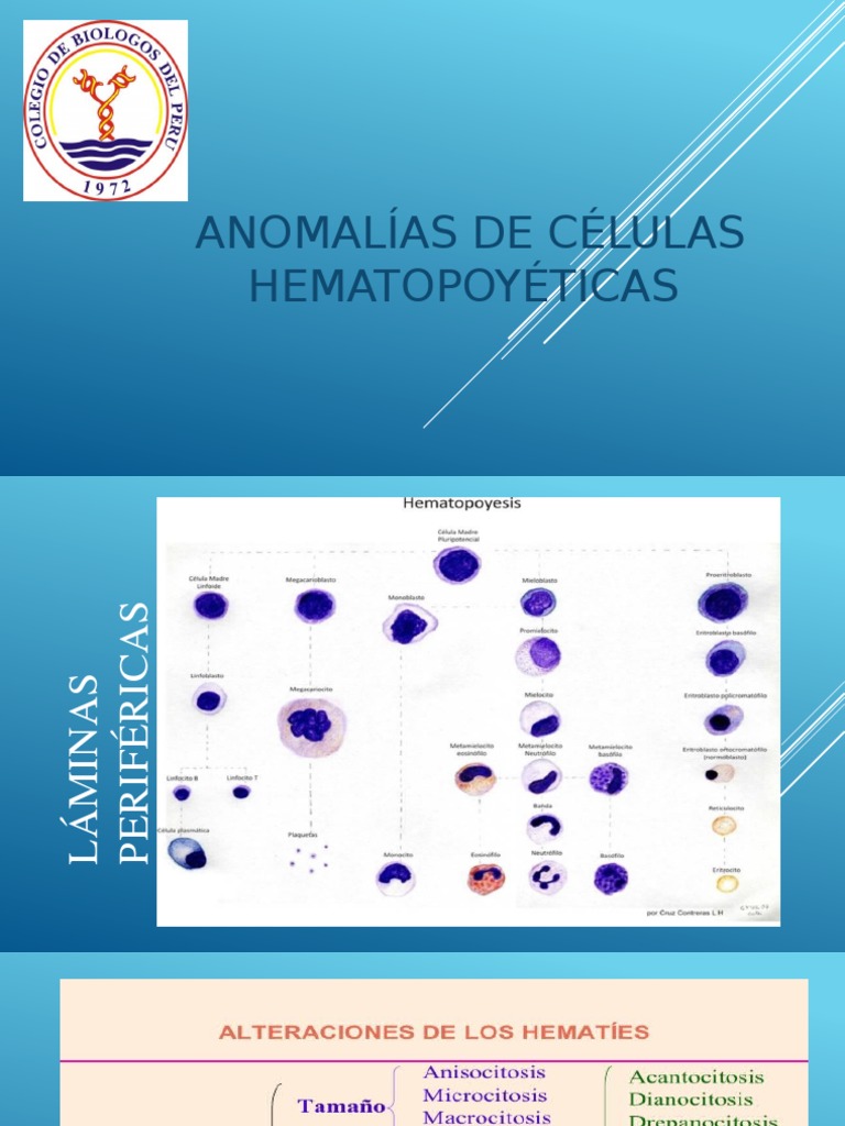 Análisis de anomalías hematológicas en láminas periféricas sanguíneas ...