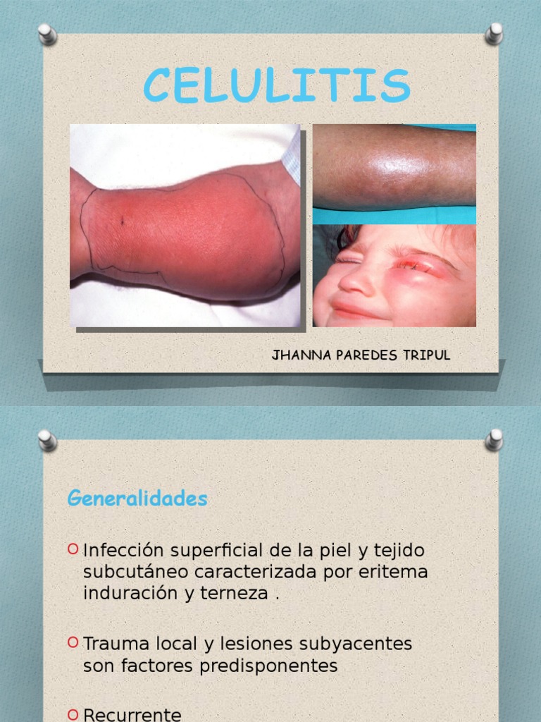 Celulitis | PDF | Enfermedades y trastornos | Medicina CLINICA