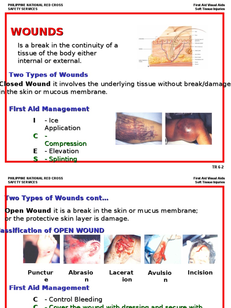Mod 6 Soft Tissue Injuries | PDF | Burn | First Aid