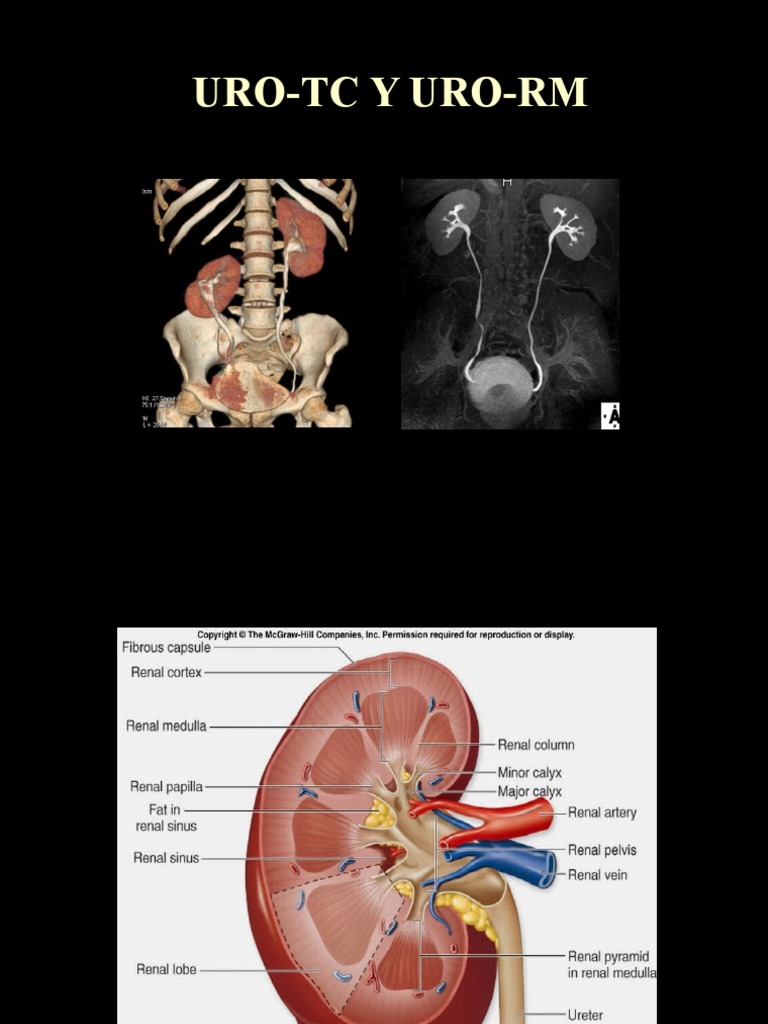 Protocolo URO-TC y URO-RM en Urología | PDF | Riñón | Sistema urinario