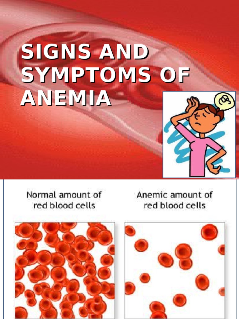 Signs and Symptoms of Anemia | PDF | Anemia | Blood