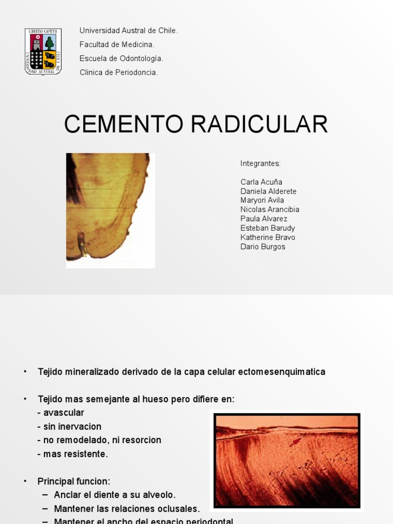 Cemento Radicular: Universidad Austral de Chile. Facultad de Medicina ...